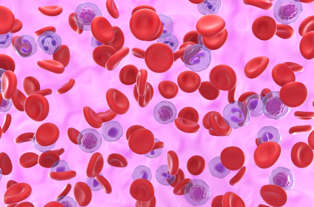 Overview of Polycythemia Vera