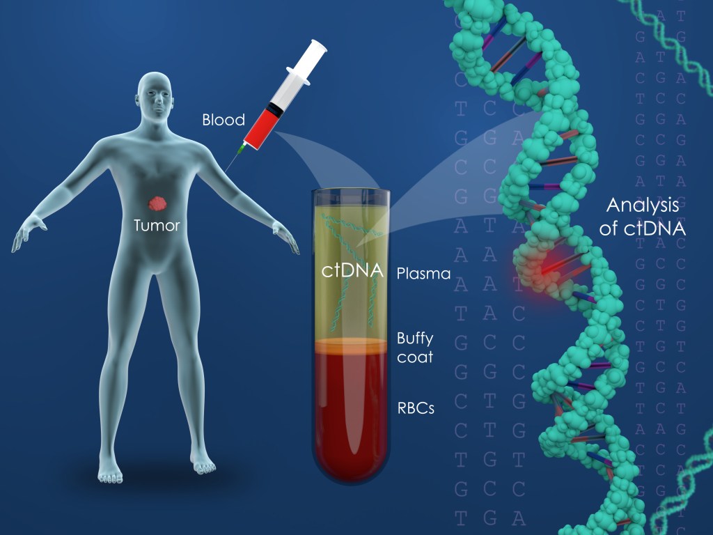 Learn how ctDNA testing can help inform breast cancer management?