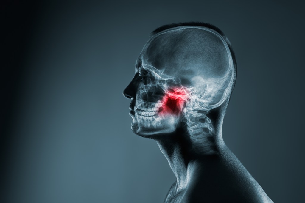 Understanding Osteonecrosis of the Jaw