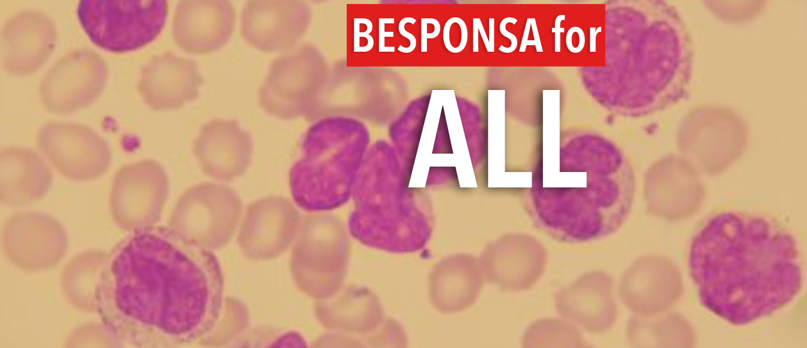 Besponsa for Refractory B- cell Acute Lymphoblastic Leukemia