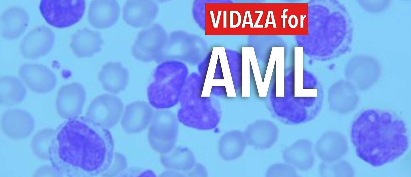 Vidaza® May Provide Alternative Treatment for Elderly Patients with AML