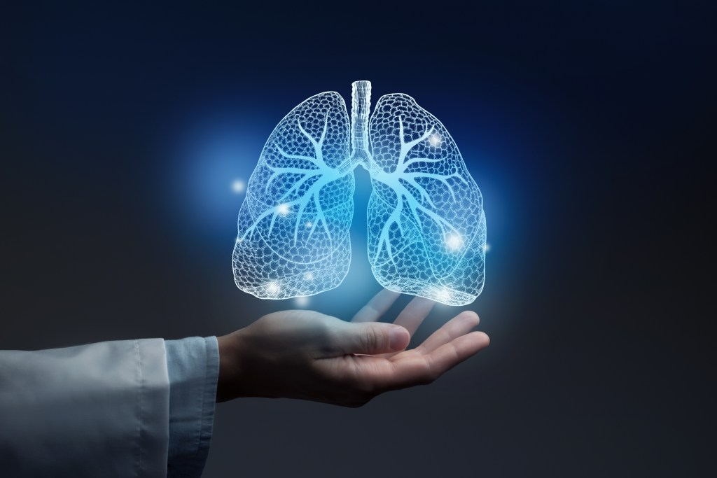 Recent Updates on Imdelltra in Extensive Stage Small Cell Lung Cancer