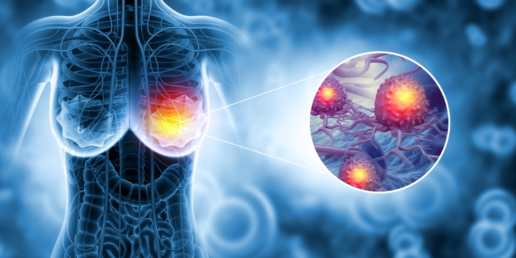 Vepdegestrant (ARV-471): FDA Fast Track Designation in ER+/HER2 ...