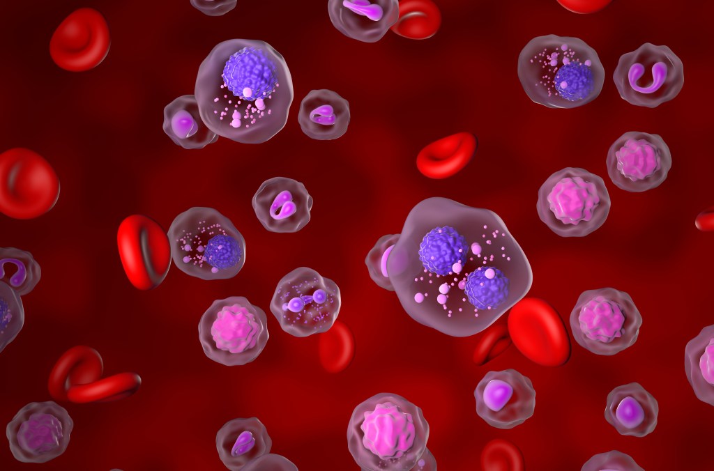 Four-Drug Combination Treatment Sets a Higher Standard for Multiple ...