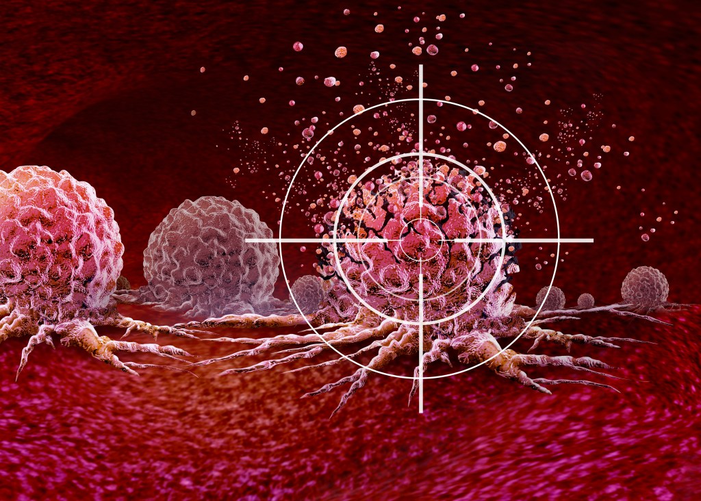 Trodelvy Shows Significant Benefit in Advanced Triple-Negative Breast ...