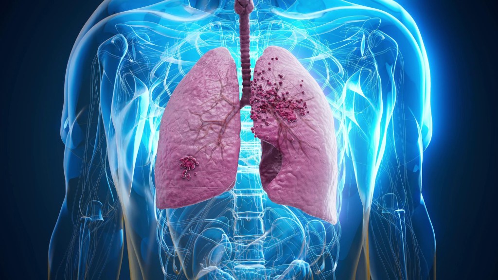 FDA Grants Accelerated Approval to New Targeted Treatment for Some HER2 ...